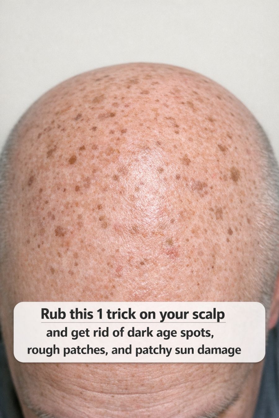 Rub this 1 trick on your scalp and get rid of dark age spots, rough ...