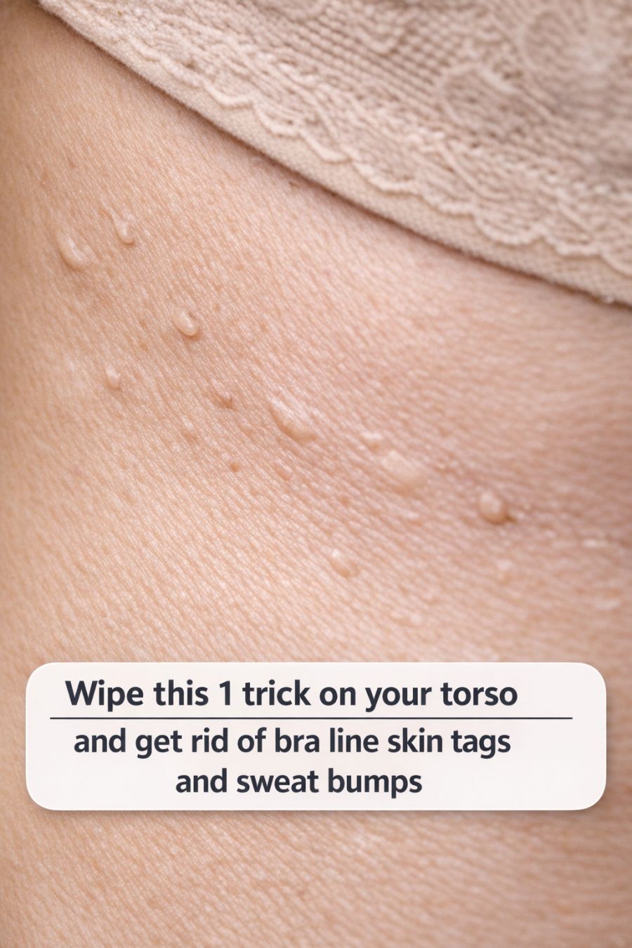 Wipe this 1 trick on your torso and get rid of bra line skin tags and ...